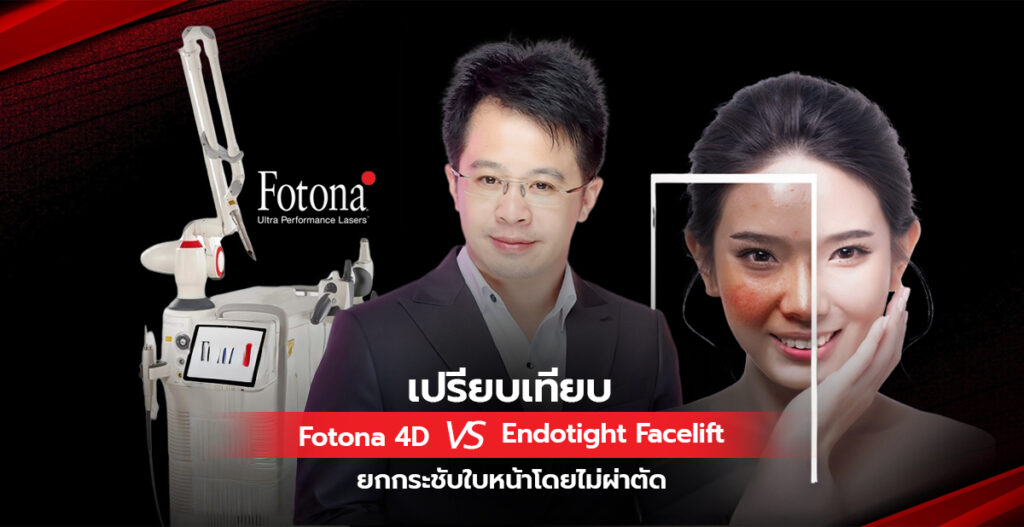 ดึงยกกระชับใบหน้าโดยไม่ผ่าตัด Fotona 4D vs Fotona EndoTight